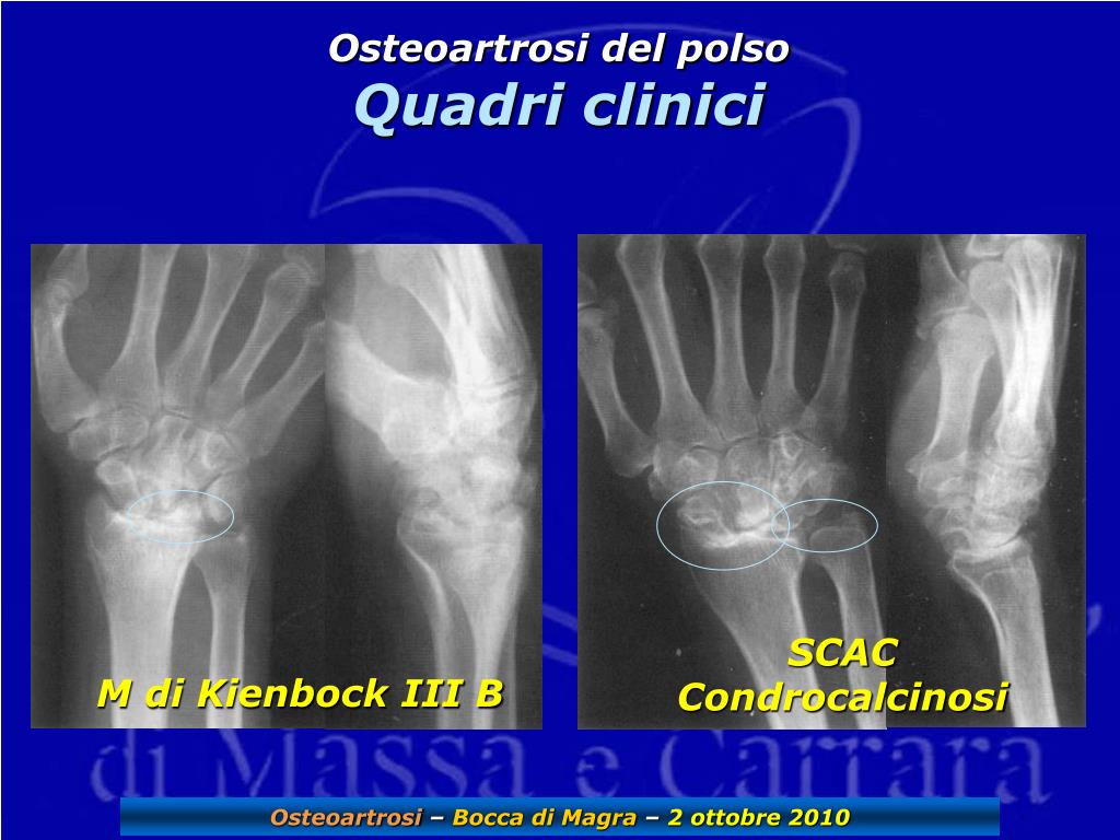 PPT - U.O. DI ORTOPEDIA E TRAUMATOLOGIA (dir. dott. Bernardo PAVOLINI ...