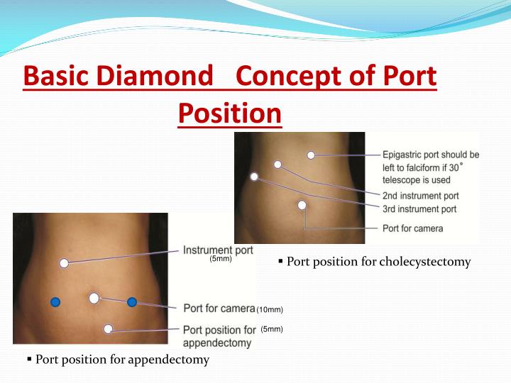 PPT - Basic principles of LAPAROSCOPIC SURGERY PowerPoint Presentation ...