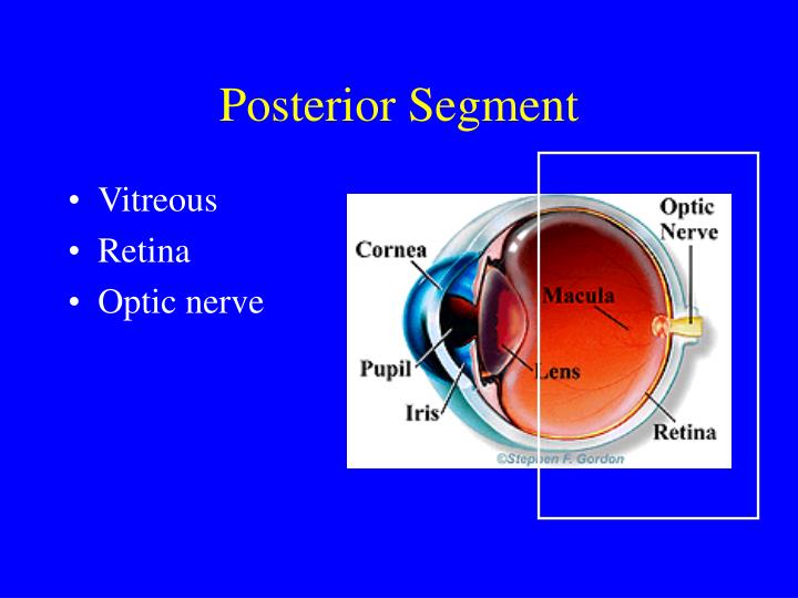PPT - Ocular Trauma PowerPoint Presentation - ID:3917049