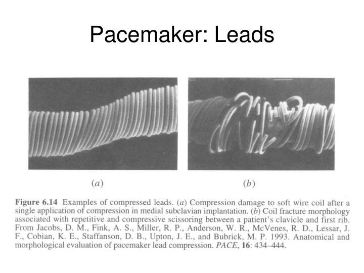 PPT - Lecture 7 Chapter 13: Therapeutic/Prosthetic Devices – Pacemakers ...