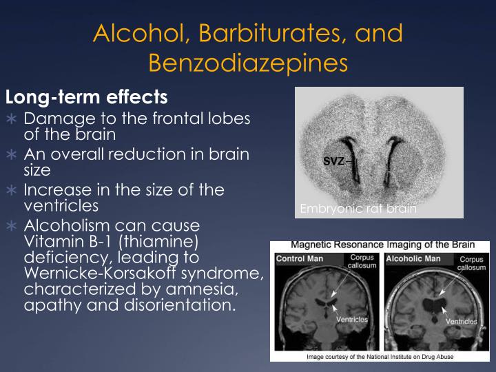 PPT - Case Study#2: Effect of Alcohol/Drugs on Teen Brain PowerPoint ...