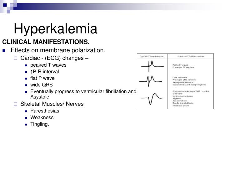 PPT - Electrolyte Abnormalities in the Hospitalized Patient PowerPoint ...