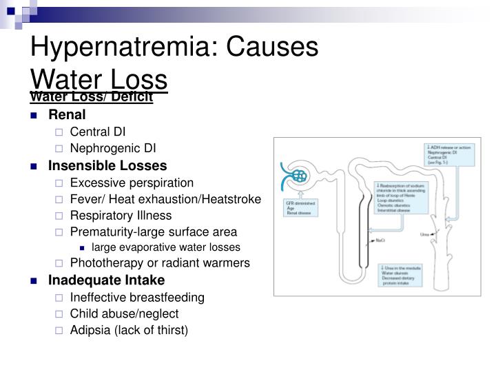 PPT - Electrolyte Abnormalities in the Hospitalized Patient PowerPoint ...
