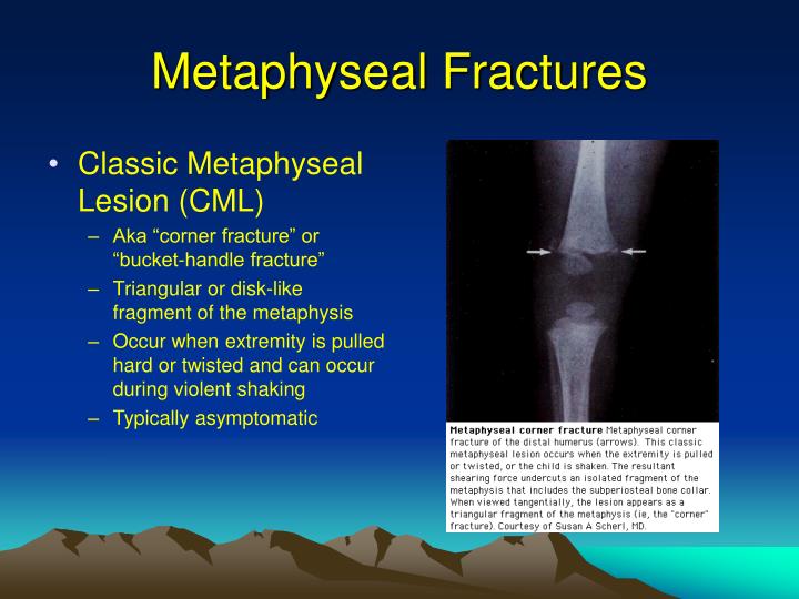 PPT - Diagnostic Evaluation in Child Abuse PowerPoint Presentation - ID ...
