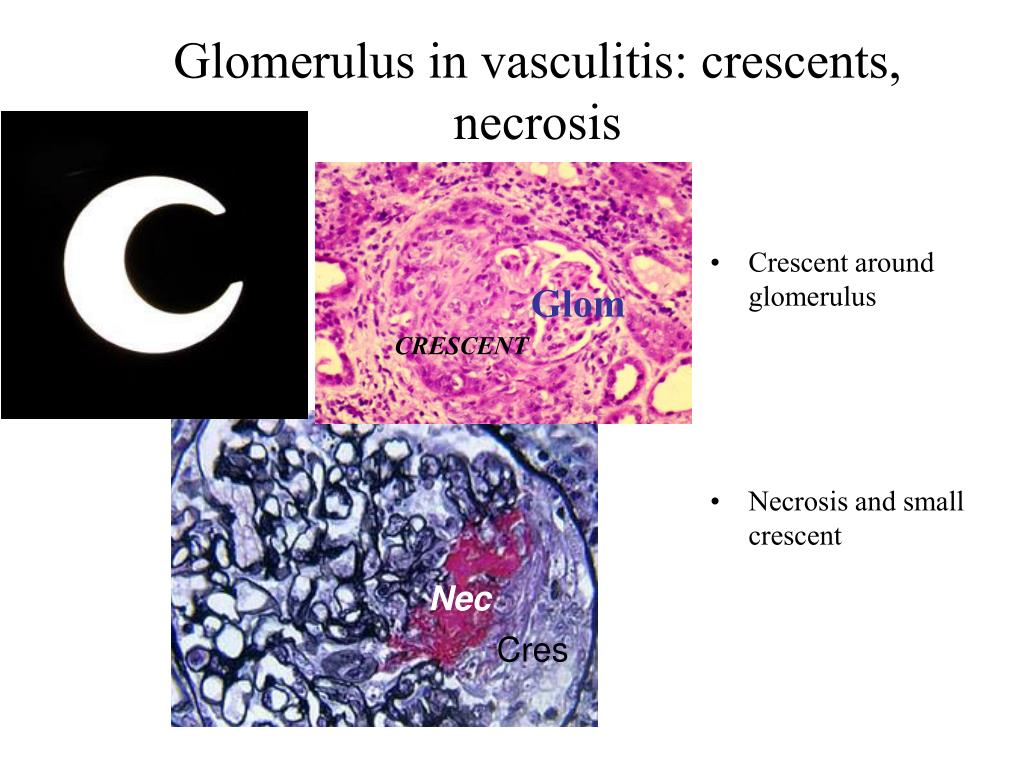 PPT - Kidney and Male GU 2010.3 PowerPoint Presentation, free download ...