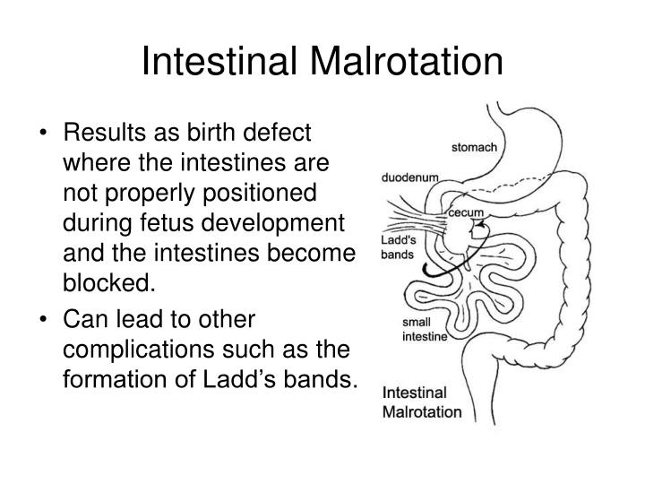 PPT - Gastro Intestinal PowerPoint Presentation - ID:3943705