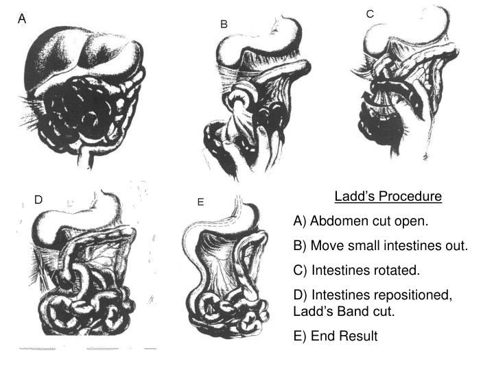 PPT - Gastro Intestinal PowerPoint Presentation - ID:3943705