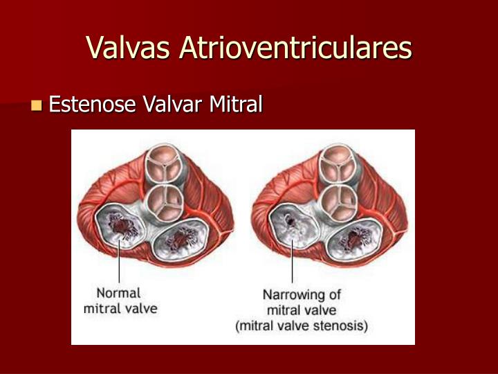PPT - Anatomia das Valvas Cardíacas PowerPoint Presentation - ID:3944214