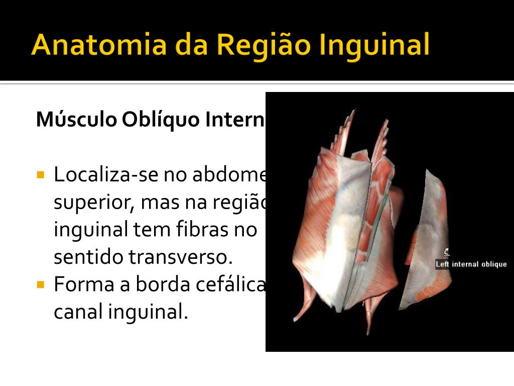 PPT - Hérnias Inguinais PowerPoint Presentation, free download - ID:3944469