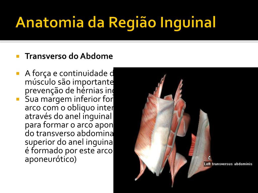 PPT - Hérnias Inguinais PowerPoint Presentation, free download - ID:3944469