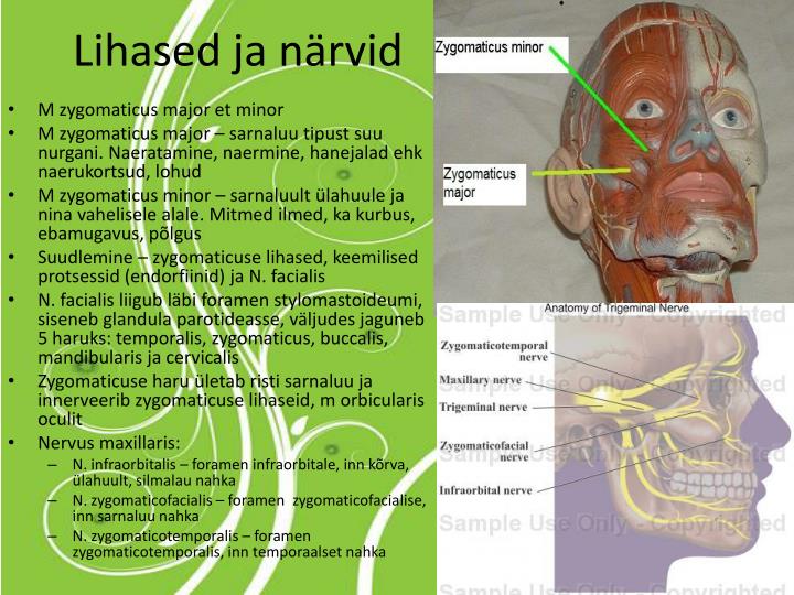 PPT - Sarnaluukeha ja –kaare murd PowerPoint Presentation - ID:3944628