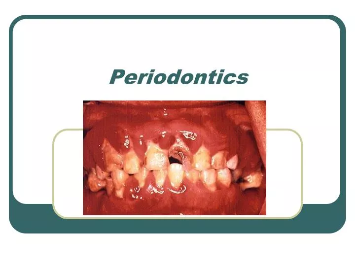 PPT - Periodontics PowerPoint Presentation, free download - ID:3945306