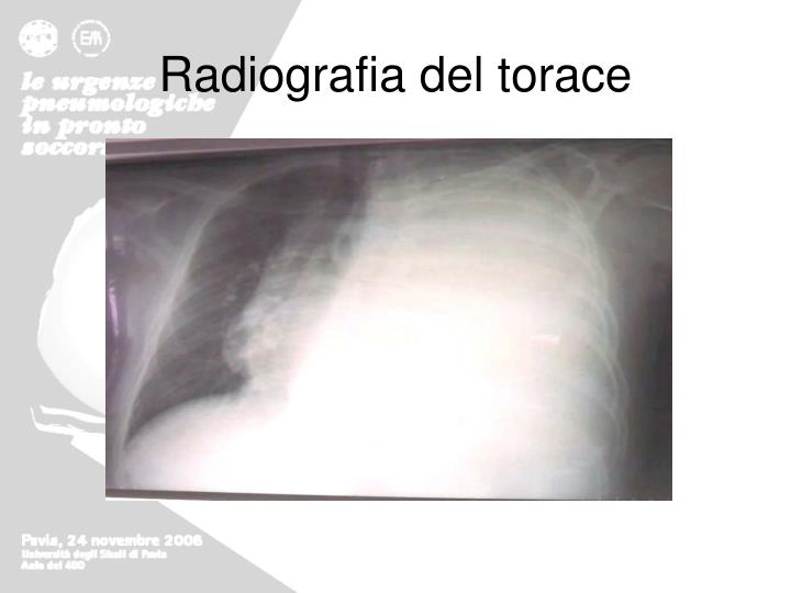 PPT - Caso clinico 1 PowerPoint Presentation - ID:3946055