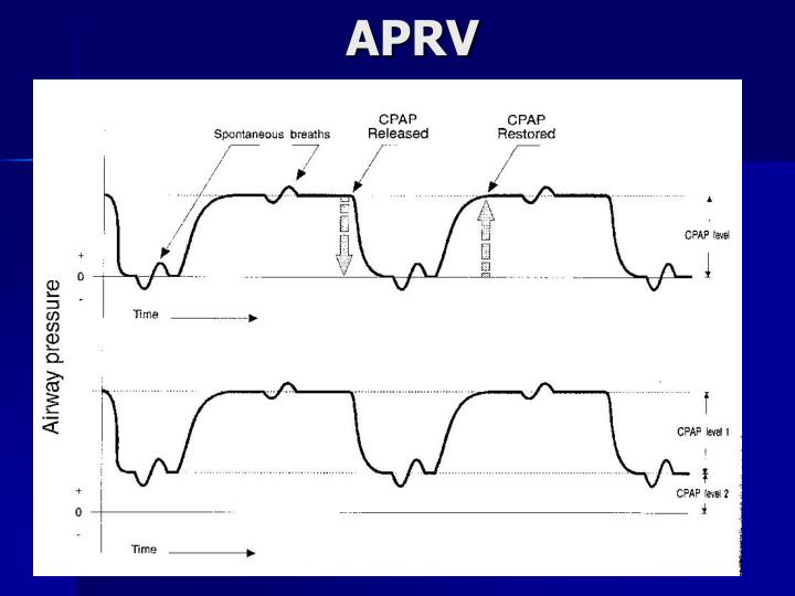 PPT - Airway Pressure Release Ventilation (APRV) PowerPoint ...