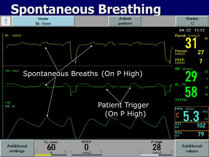 PPT - Airway Pressure Release Ventilation (APRV) PowerPoint ...