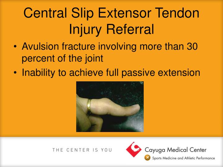 PPT - Common Hand and Wrist Injuries PowerPoint Presentation - ID:3950482
