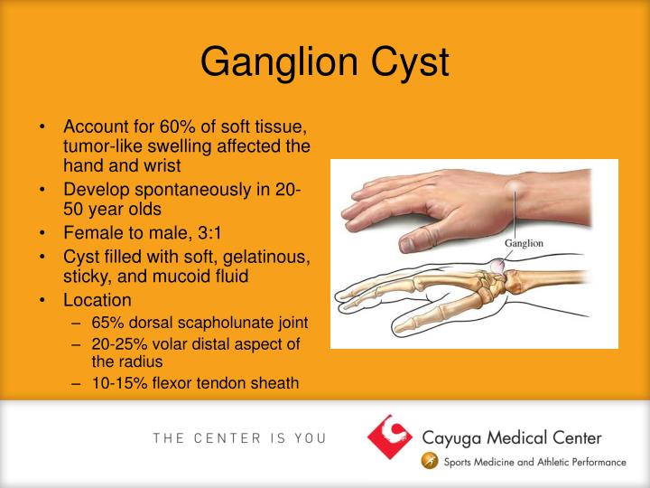 PPT - Common Hand and Wrist Injuries PowerPoint Presentation - ID:3950482