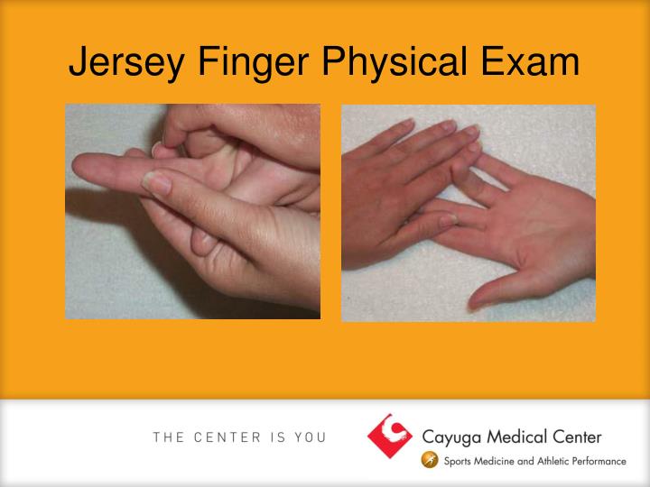 PPT - Common Hand and Wrist Injuries PowerPoint Presentation - ID:3950482