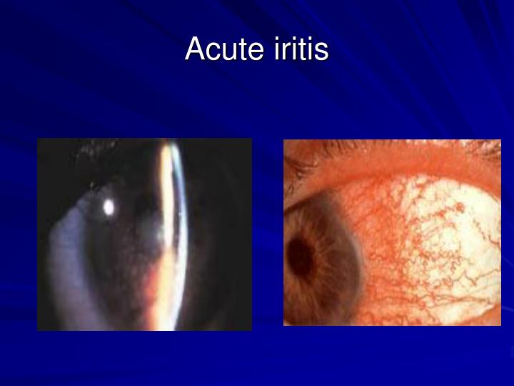 PPT - Ophthalmologic Emergencies PowerPoint Presentation - ID:3951268
