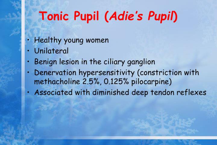 PPT - PUPILS PowerPoint Presentation - ID:3956174