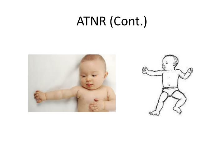 PPT - Child Development Reflexes PowerPoint Presentation - ID:3959645