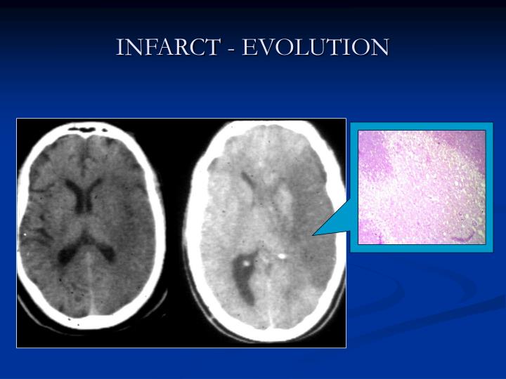 PPT - Traumatic Brain Injury PowerPoint Presentation - ID:3964316