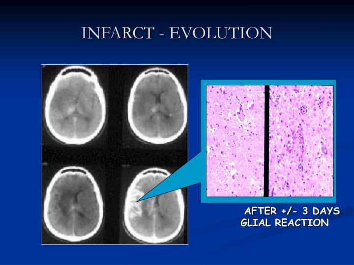 PPT - Traumatic Brain Injury PowerPoint Presentation - ID:3964316