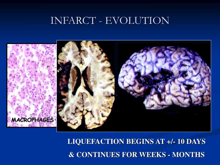PPT - Traumatic Brain Injury PowerPoint Presentation - ID:3964316
