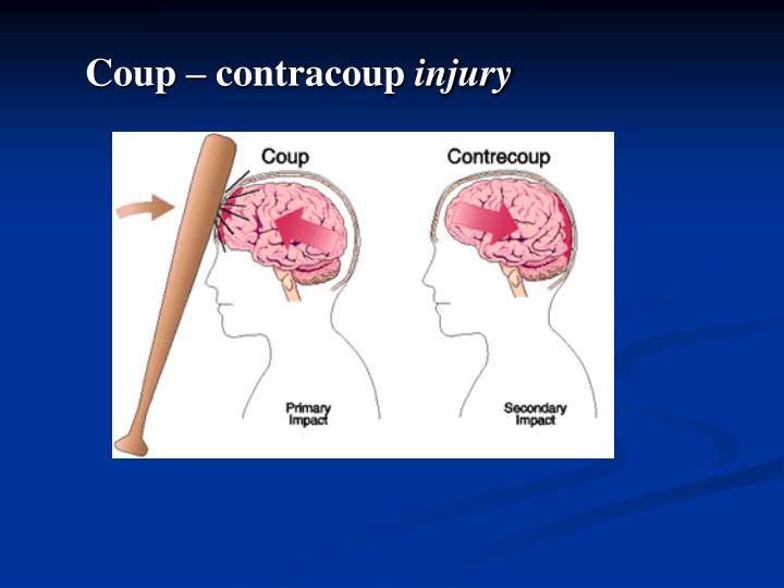 PPT - Traumatic Brain Injury PowerPoint Presentation - ID:3964316