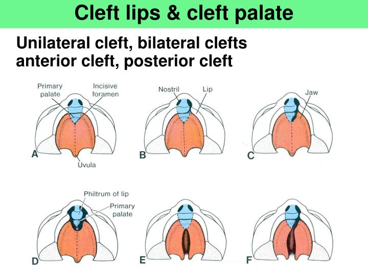 PPT - Branchial Apparatus PowerPoint Presentation - ID:3968103