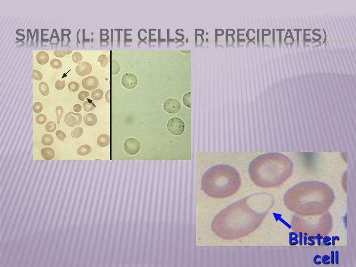 PPT - Heinz body anemia PowerPoint Presentation - ID:3969415