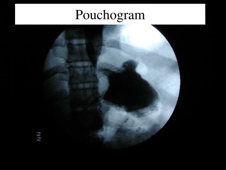 PPT - Gastric ‘Polyposis’ Case Report PowerPoint Presentation - ID:3977913