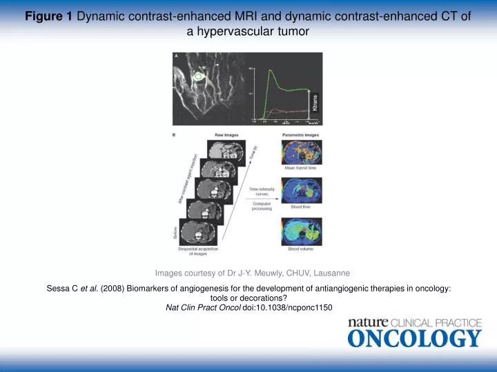 PPT - Figure 1 Dynamic contrast-enhanced MRI and dynamic contrast ...