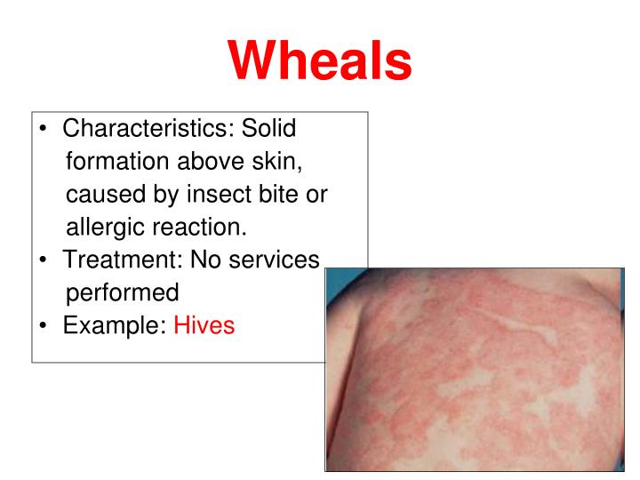 PPT - Skin Theory PowerPoint Presentation - ID:3987416