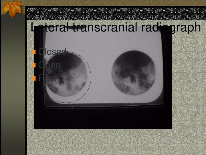 PPT - TMJ Radiography PowerPoint Presentation - ID:3988079