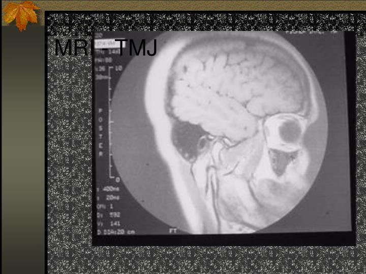 PPT - TMJ Radiography PowerPoint Presentation - ID:3988079