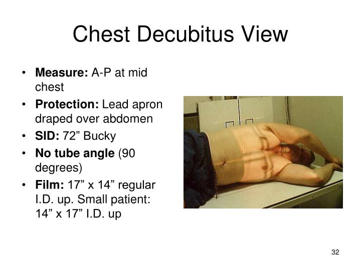 PPT - Abdominal Radiography PowerPoint Presentation - ID:3998327