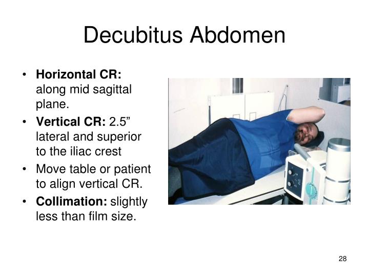 PPT - Abdominal Radiography PowerPoint Presentation - ID:3998327