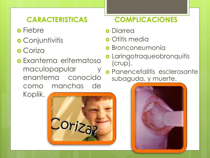 PPT - SARAMPION PowerPoint Presentation - ID:4003056