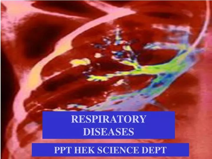 PPT - RESPIRATORY DISEASES PowerPoint Presentation, free download - ID ...