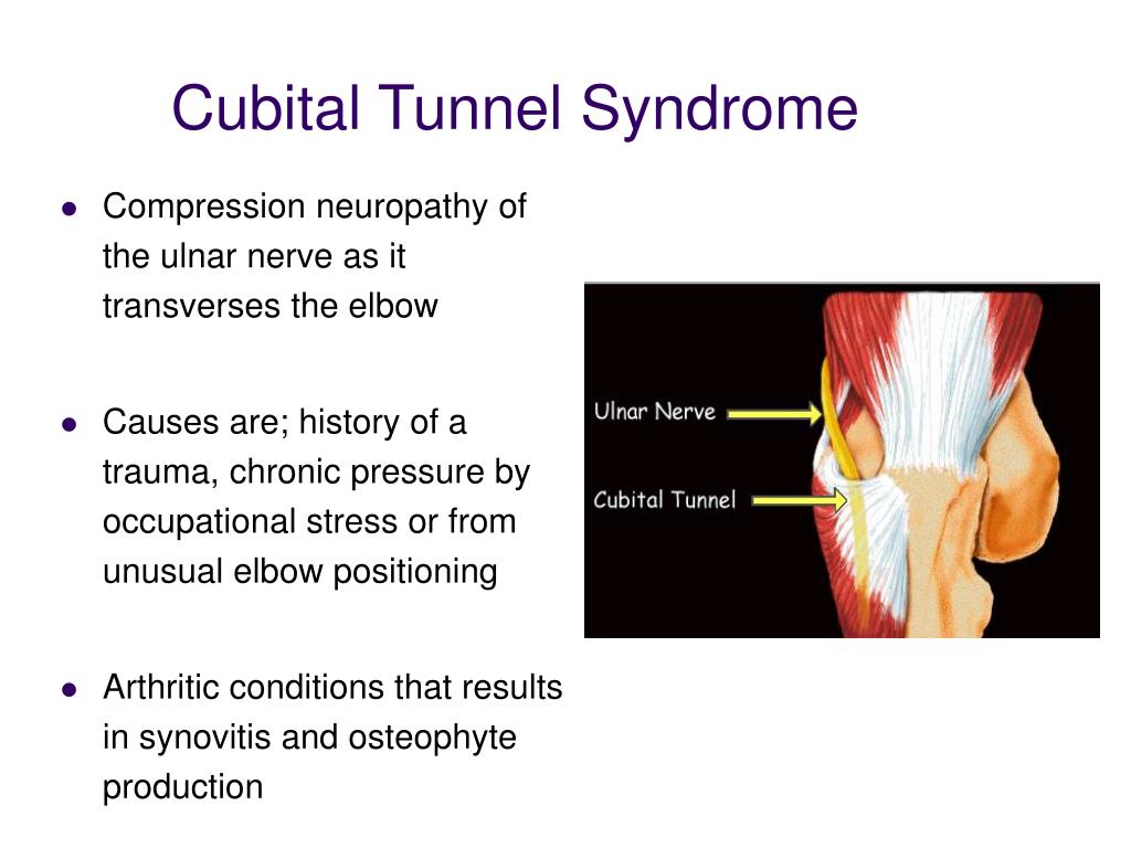 PPT - Soft Tissue Rheumatism PowerPoint Presentation, free download ... PPT - Soft Tissue Rheumatism PowerPoint Presentation, free download ...