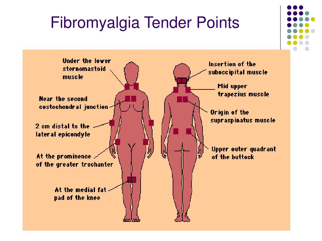 PPT - Soft Tissue Rheumatism PowerPoint Presentation, free download ... PPT - Soft Tissue Rheumatism PowerPoint Presentation, free download ...
