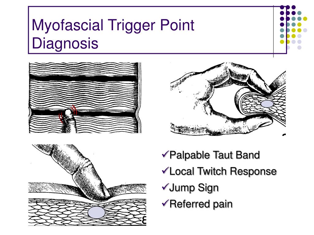 PPT - Soft Tissue Rheumatism PowerPoint Presentation, free download ... PPT - Soft Tissue Rheumatism PowerPoint Presentation, free download ...