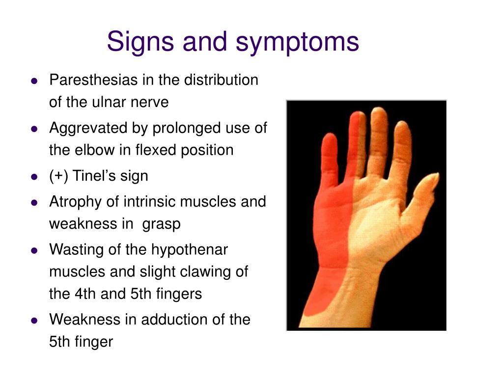 PPT - Soft Tissue Rheumatism PowerPoint Presentation, free download ... PPT - Soft Tissue Rheumatism PowerPoint Presentation, free download ...