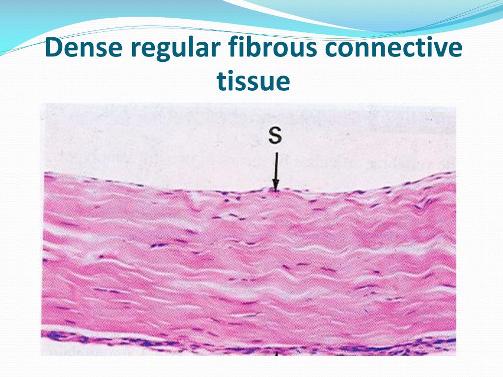 Fibrous Connective Tissue Diagram