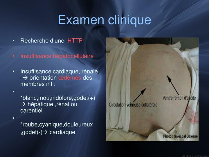 PPT - L’Ascite PowerPoint Presentation - ID:4011803