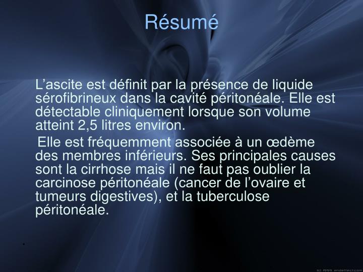PPT - L’Ascite PowerPoint Presentation - ID:4011803