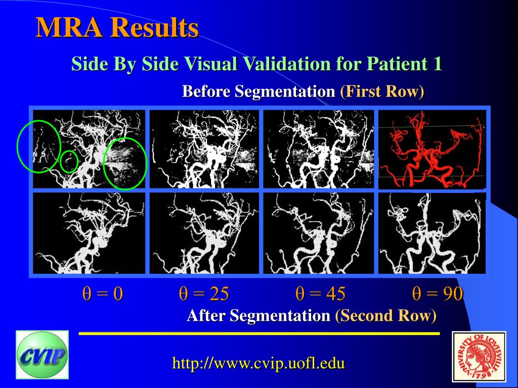 PPT - M. Sabry M., Charles B. Sites, Aly A. Farag, Stephen Hushek, and ...