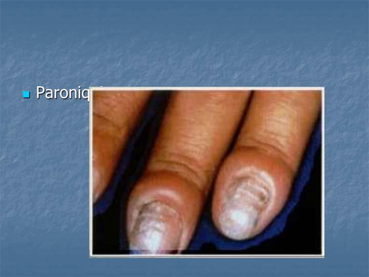 PPT - SISTEMA TEGUMENTAR PowerPoint Presentation - ID:4012506