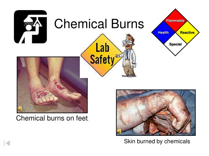 PPT - Safety PowerPoint Presentation - ID:4012755